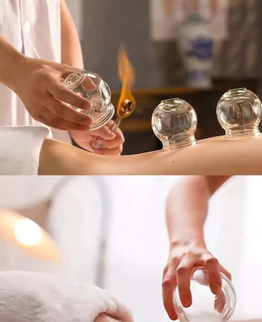 Shanghai: Chinese Medicine Acupuncture and Cupping Session - Key Points