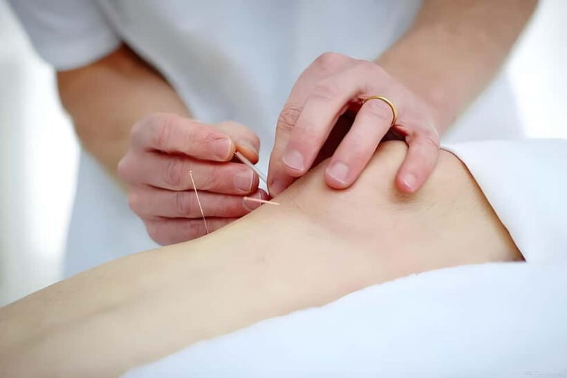 Shenzhen: Acupuncture Experience with TCM Practitioner - Final Thoughts