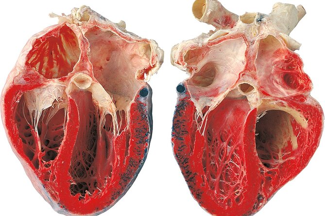 Ticket Expo Body Worlds in Bruges, Belgium - Visitor Experience and Reviews